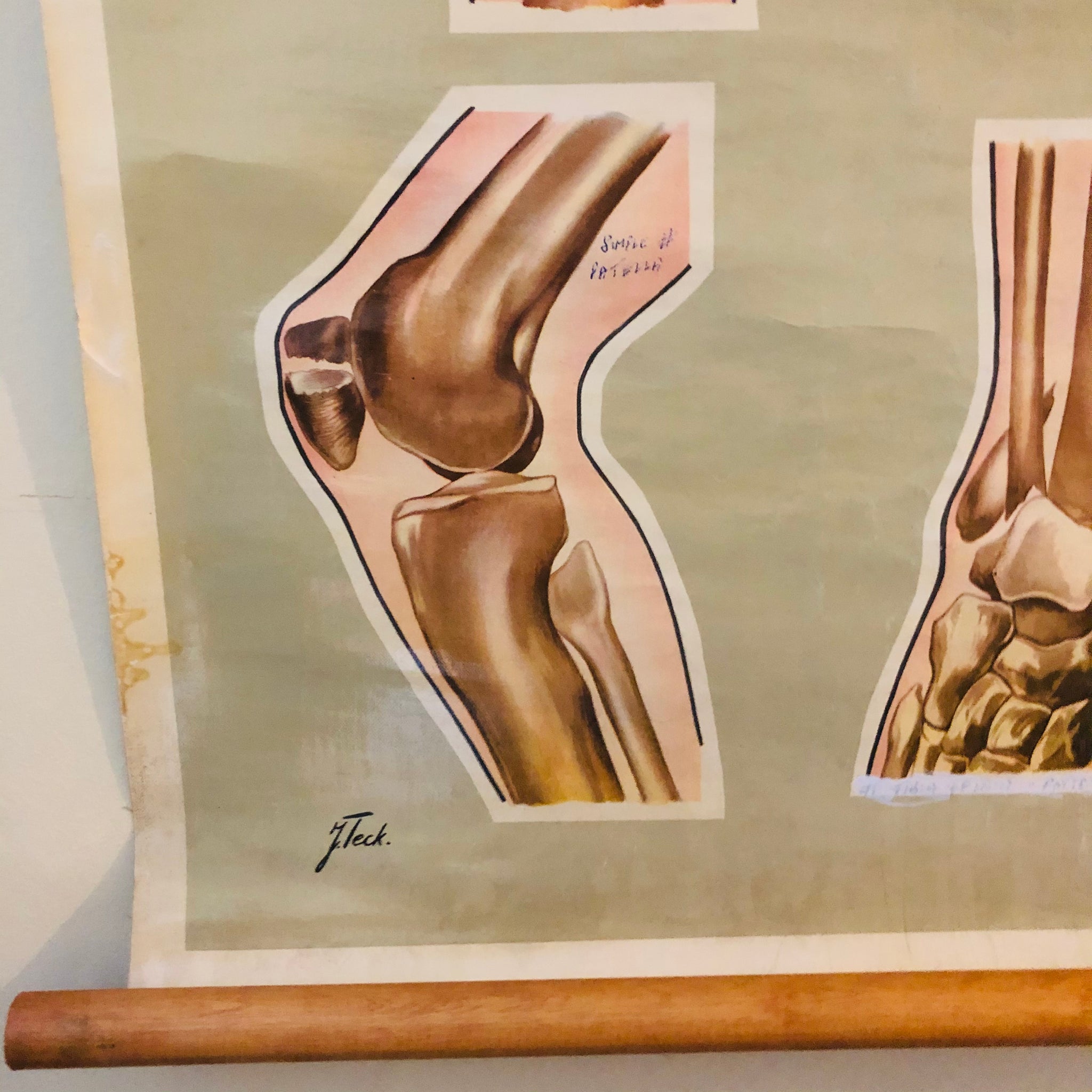 Vintage Fracture Poster St John Ambulance Anatomical By J Teck | Wall ...